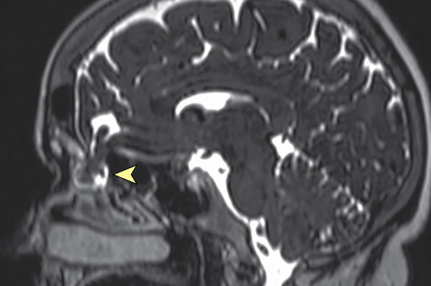 Requirements For The Liberal Brain! | Touch Stone Connect