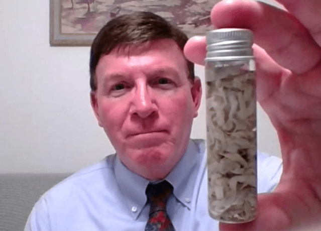 COVID Calamari Type Clots In The Living! What’s Not To Like? | Touch ...